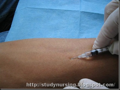 Nursing Articles: MANTOUX TEST